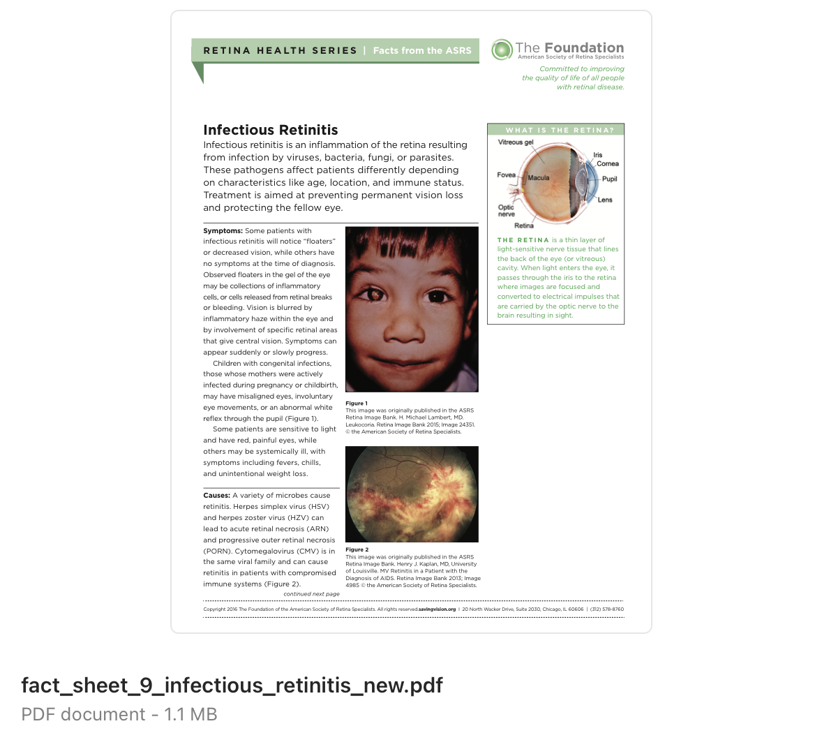 asrs infection – Retina Orange County