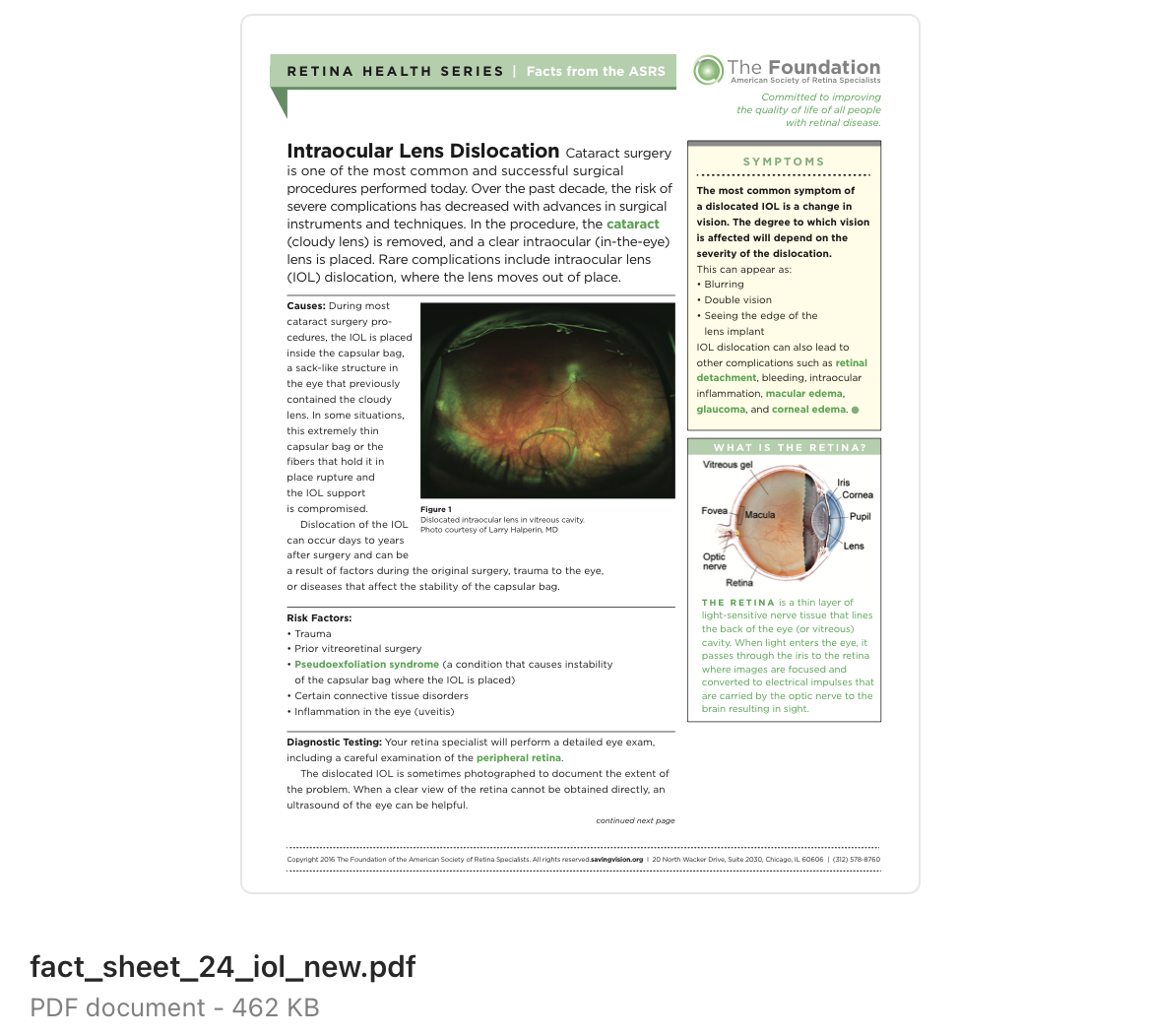 asrs iol – Retina Orange County