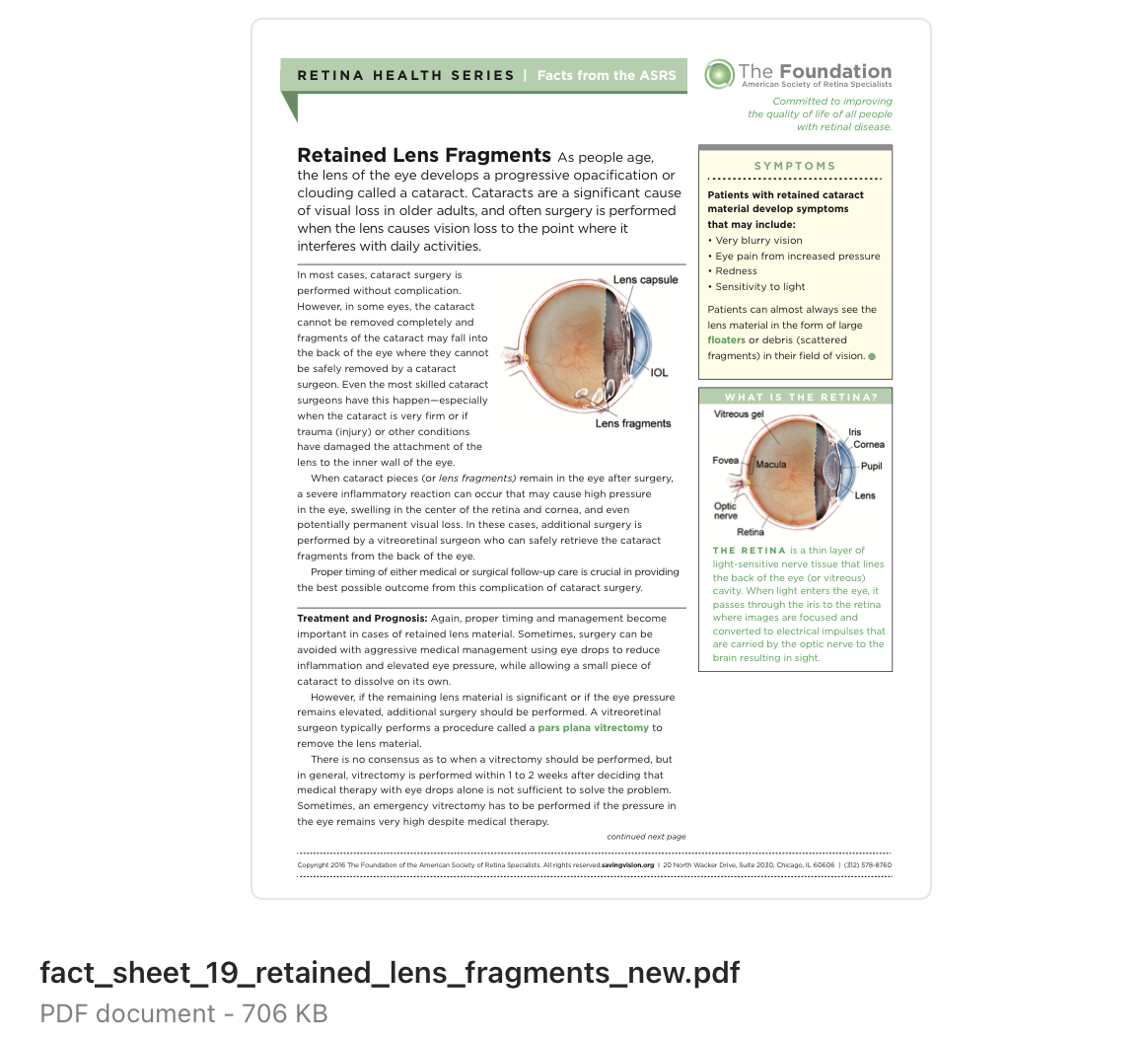 asrs lens – Retina Orange County
