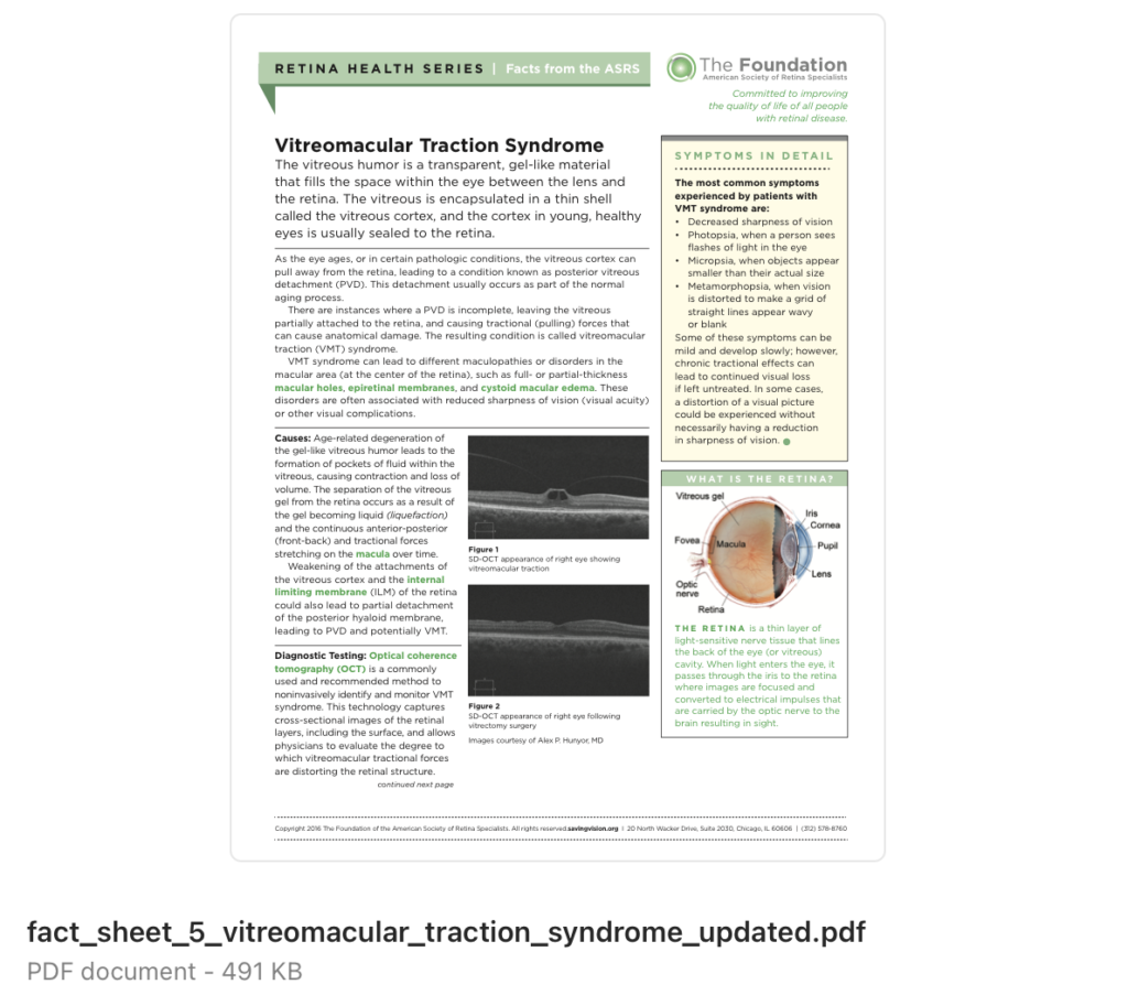asrs vmt – Retina Orange County