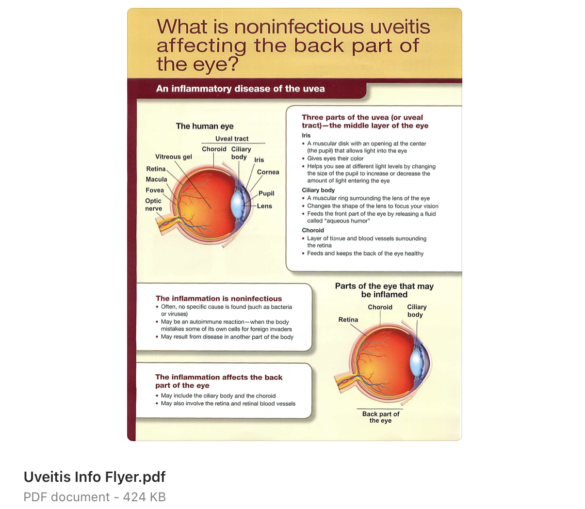 uveitis – Retina Orange County